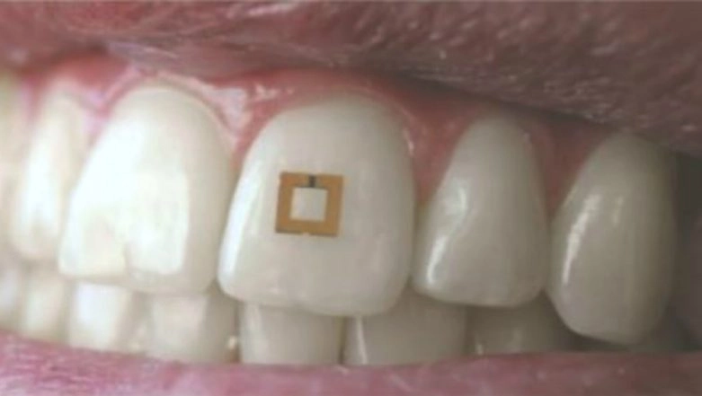 Now a Tooth Sensor Can Trace What you Eat and Keep you Healthy | 📲 LatestLY