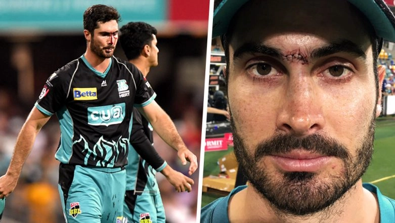 Ben Cutting Injures Nose After Failing to Take a Catch in BBL 2018–19 ...