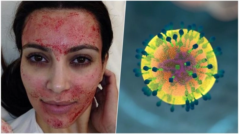 ‘Vampire’ Facials Leave 2 People HIV Positive in New Mexico; Unsafe Spa ...