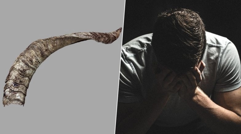 MP Man Grows Devil's Horn After Head Injury; Doctors Call it a Rare ...