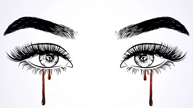 Bleeding Eyes During Periods: Woman Gets Tears of Blood During ...