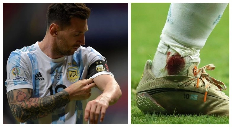 Lionel Messi Played with a Bleeding Ankle in the Second Half Against ...