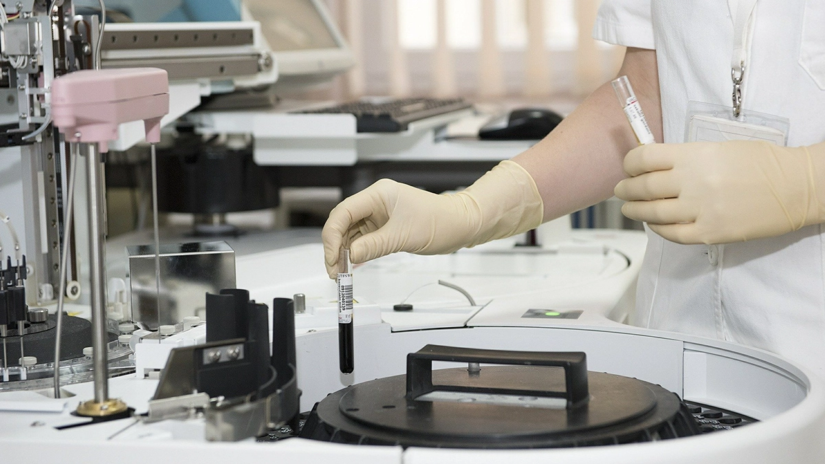 Health & Wellness News | Know About Causes, Symptoms, Prevention And ...