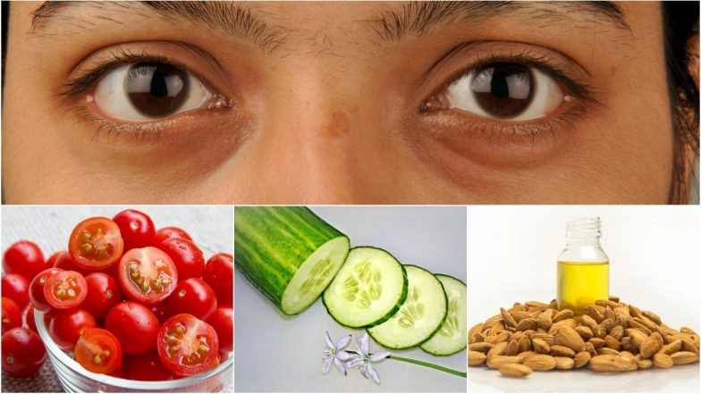 How To Get Rid of Dark Circles Under the Eyes Naturally? Try These Home Remedies To Remove Eye ...
