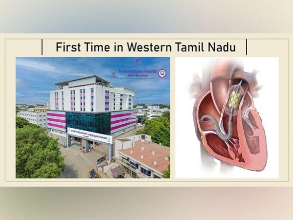 Business News | Sri Ramakrishna Hospital Introduces Groundbreaking TPVR Procedure; Successfully ...