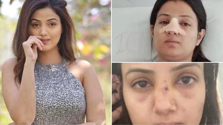 Kismat Ki Lakiro Se Fame Sumati Singh Opens Up About Her Nose Surgery ...