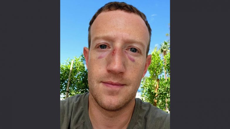 Meta Founder Mark Zuckerberg’s Selfie Reveals Swelling and Bruises ...