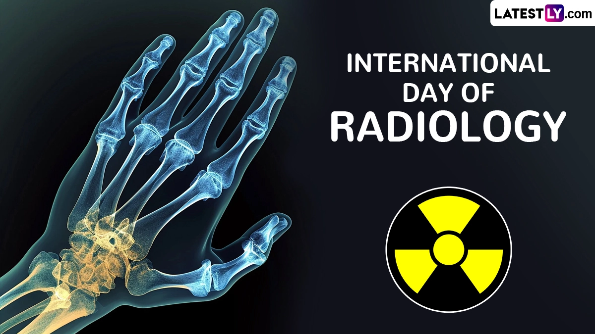 Festivals & Events News | Everything You Need to Know About International Day of Radiology 2024 ...
