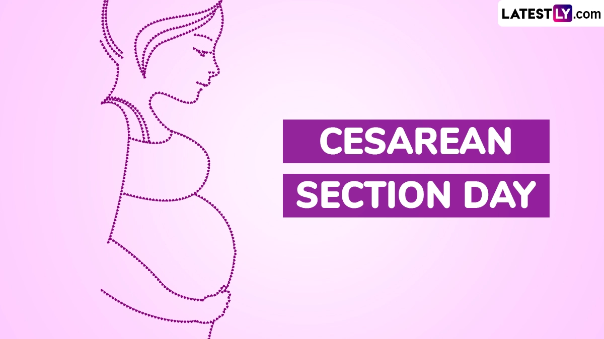 Festivals & Events News | Everything You Need to Know About Cesarean ...