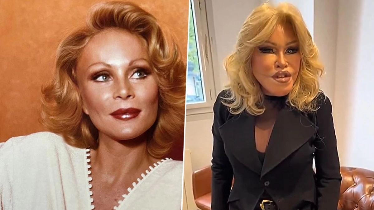 Jocelyn Wildenstein Before Jocelyne Wildenstein, Swiss Socialite Known