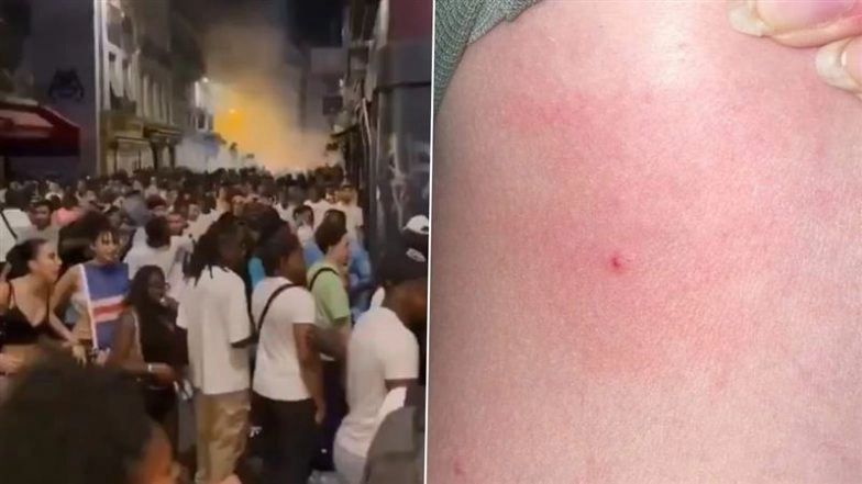 Syringe Attack in France: 145 People Pricked With Needle During Fete de ...